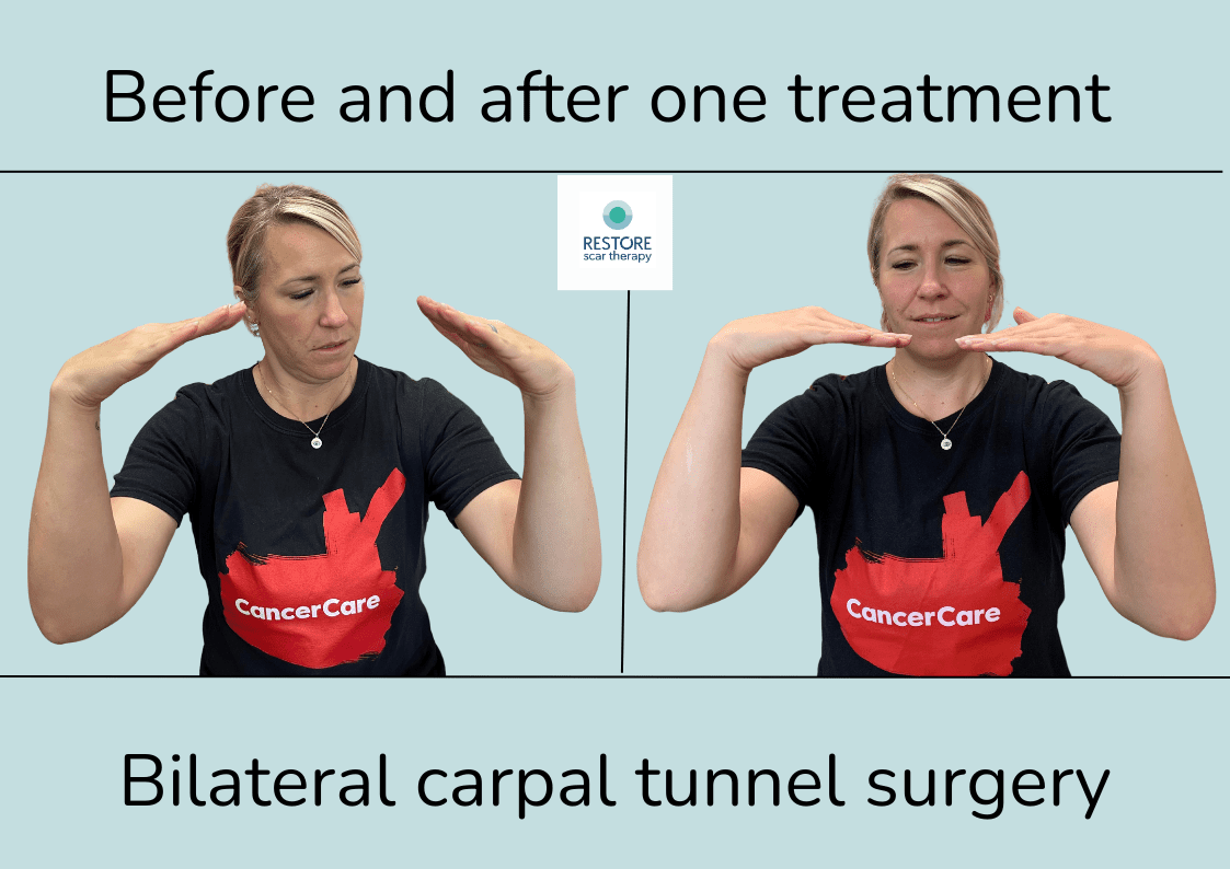Scar Therapy Practitioner Course | Restore Therapy